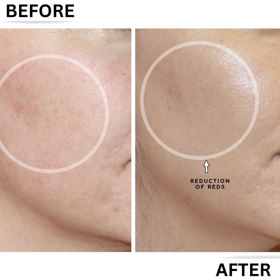 CryoGLO Roller :: Helps reduce puffiness, tighten skin, and calm redness