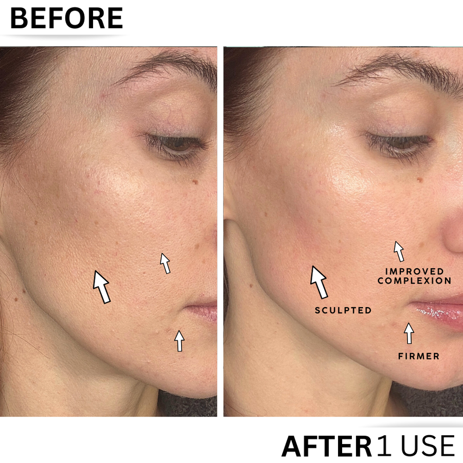 CryoGLO Roller :: Helps reduce puffiness, tighten skin, and calm redness