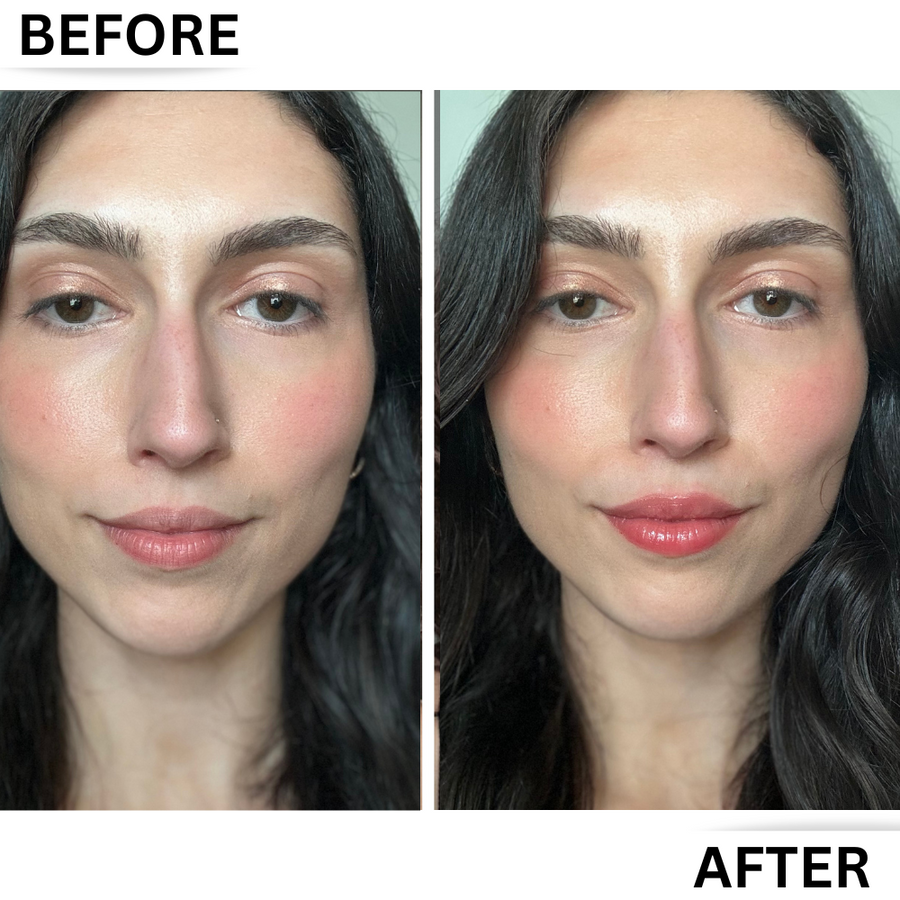 Lip Enhancer: Natural Full Lips, Short & Long-Term Benefits