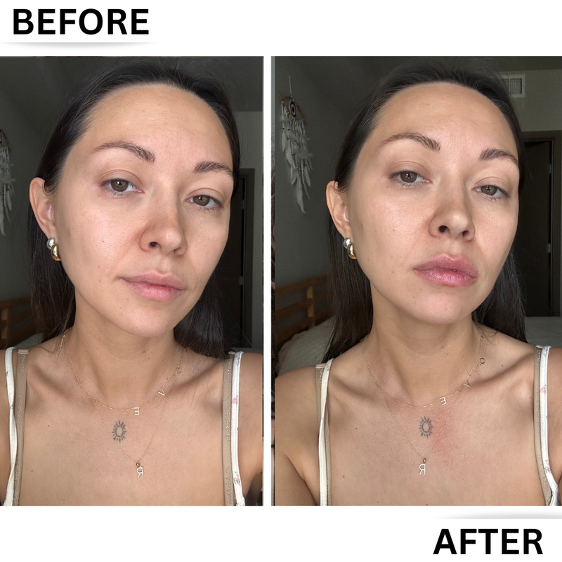 Lip Enhancer: Natural Full Lips, Short & Long-Term Benefits