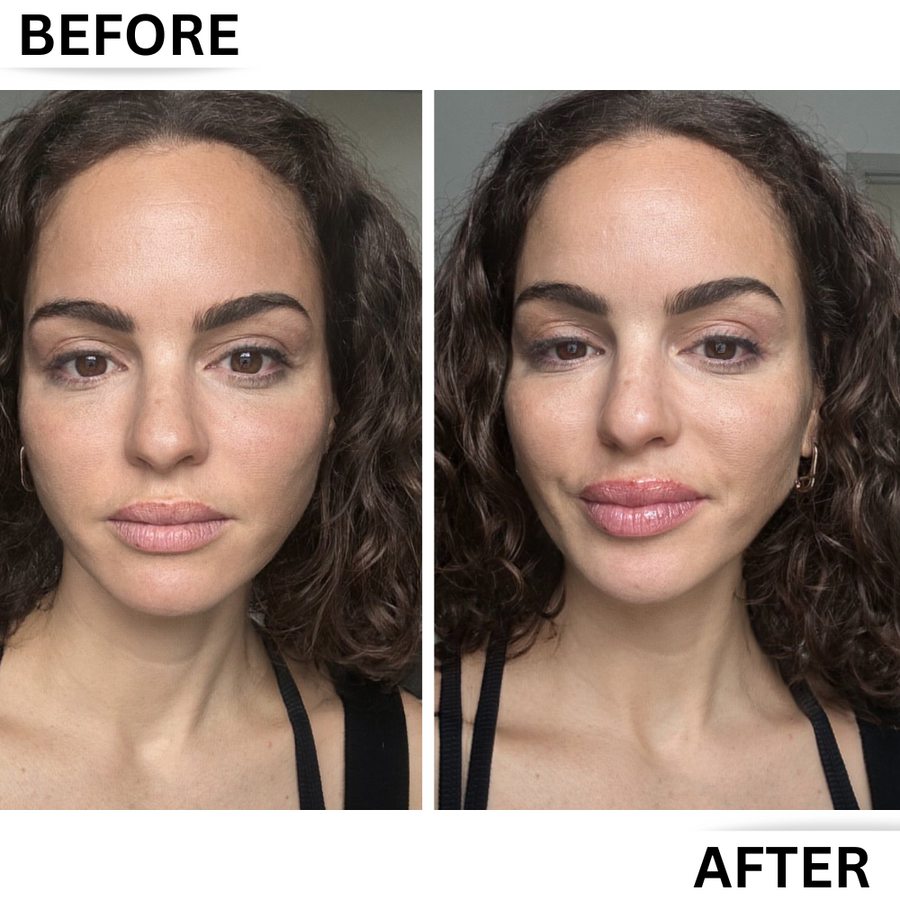 Lip Enhancer: Natural Full Lips, Short & Long-Term Benefits