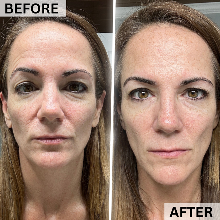 PlasmaGLO™ LED Face and Jowl Mask