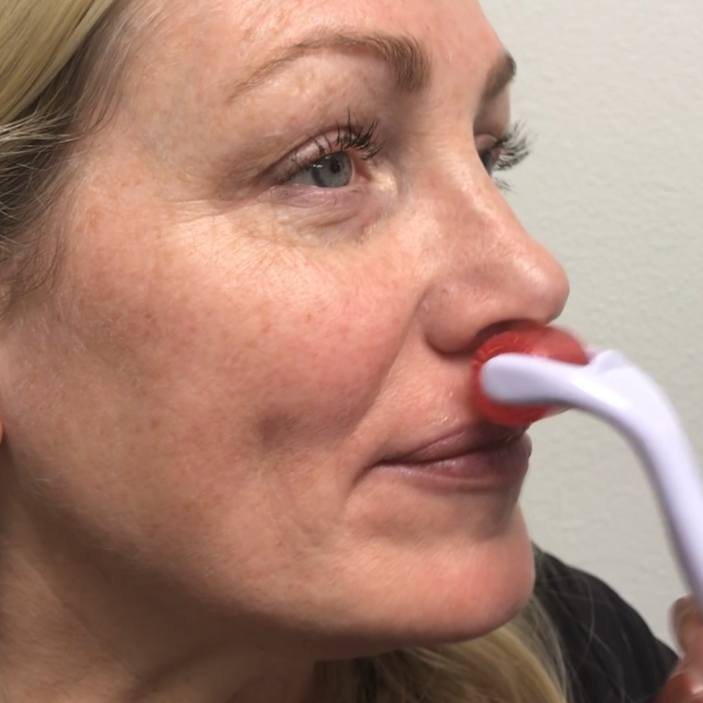 Dr Rajani's Micro-Needle Course