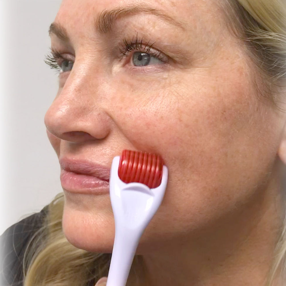 Home Microneedling Intro System Enhance Your Skin’s Healing Response