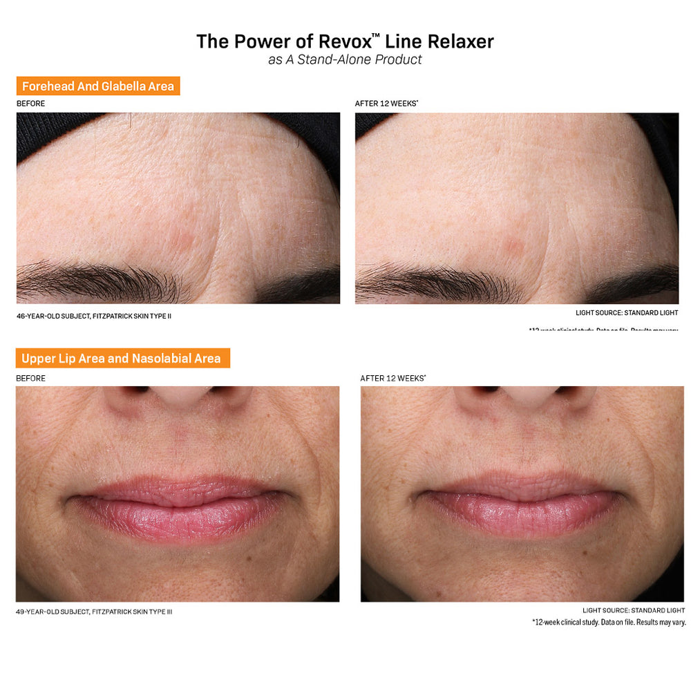 Revox™ Line Relaxer To Help Reduce Appearance Of Fine Lines & Wrinkles
