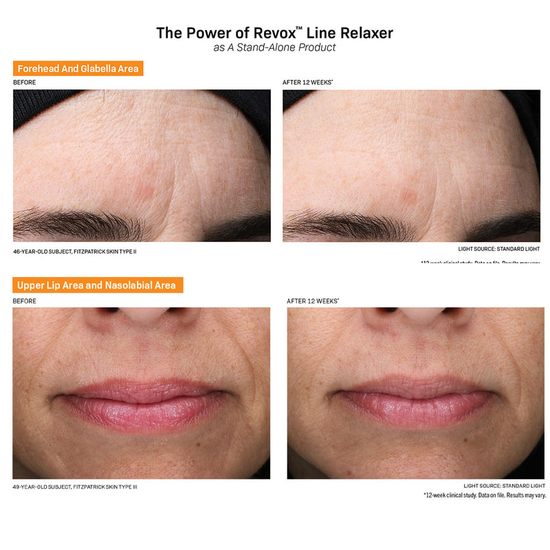 Revox™ Line Relaxer To Help Reduce Appearance Of Fine Lines & Wrinkles