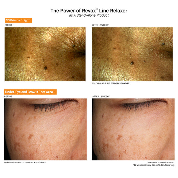 Revox™ Line Relaxer To Help Reduce Appearance Of Fine Lines & Wrinkles